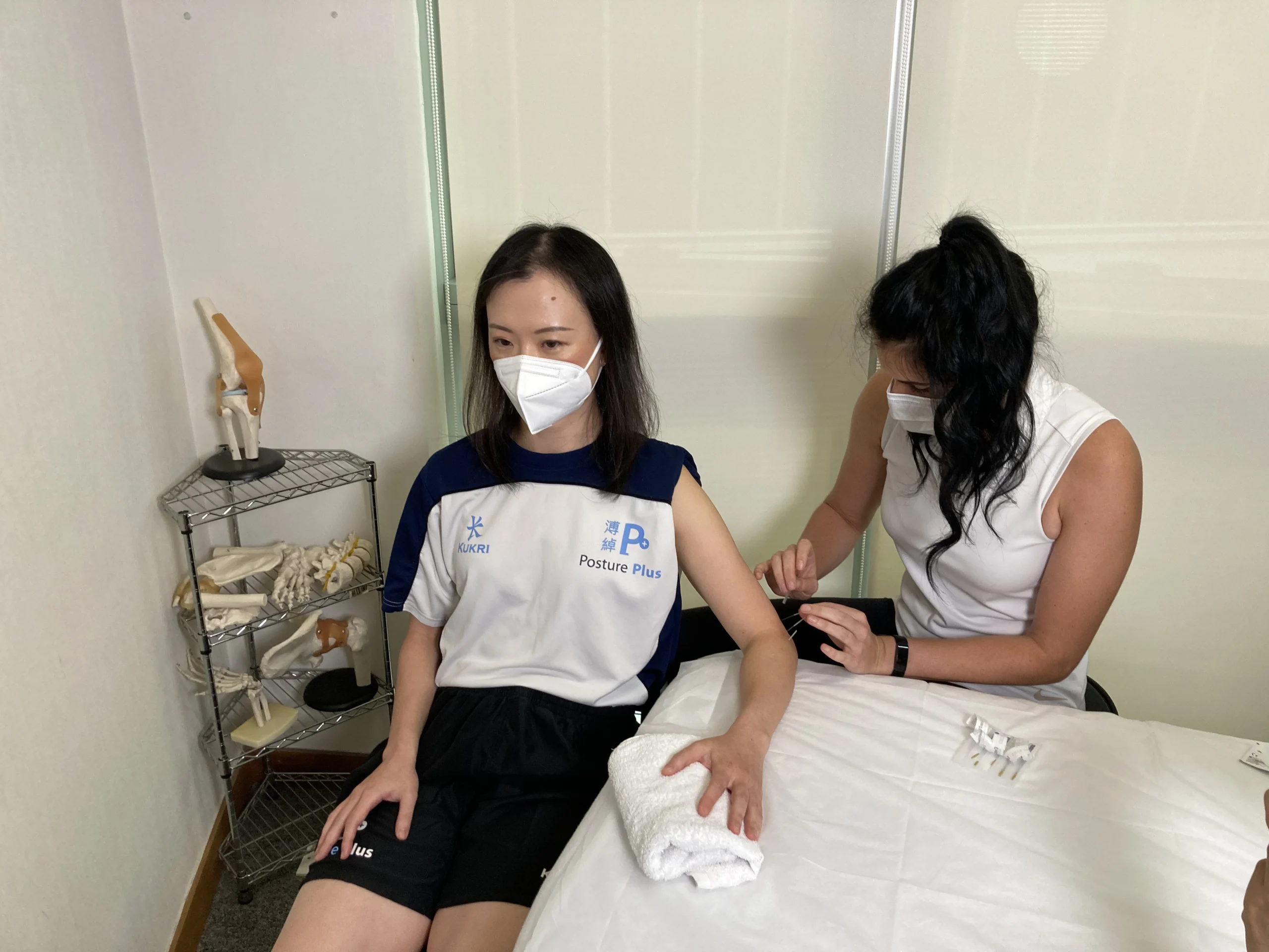 Acupuncture & Dry Needling - Posture Plus