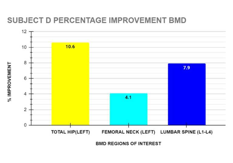 Case Study: ONERO Exercise for Osteoporosis | Posture Plus HK